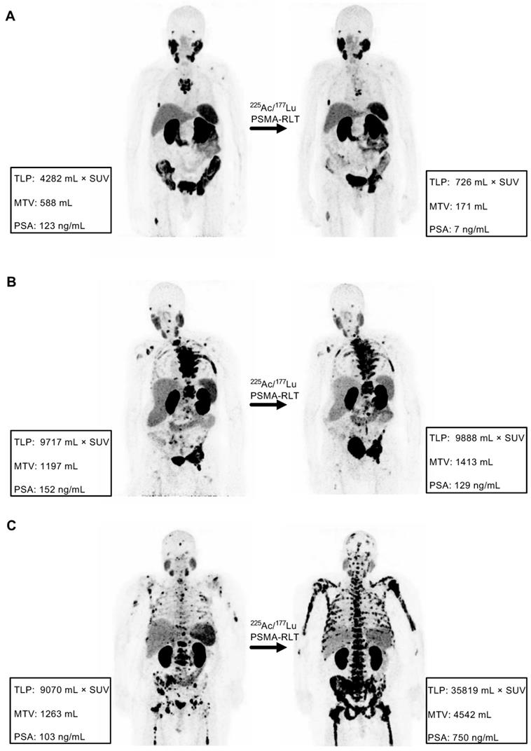 Molecular imaging and biochemical response assessment after a single ...