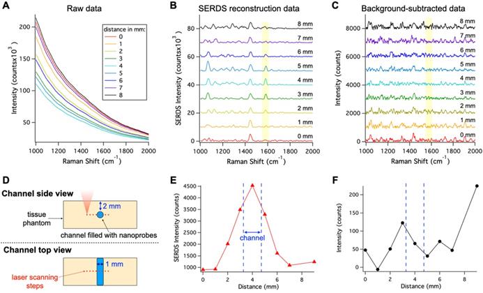 Accurate in vivo tumor detection using plasmonic-enhanced shifted ...