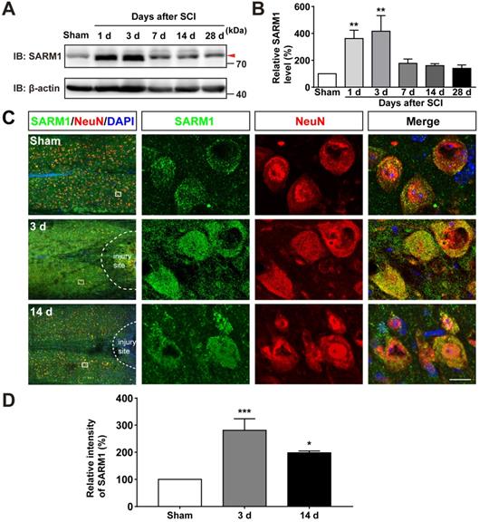 SARM1 promotes neuroinflammation and inhibits neural regeneration after ...