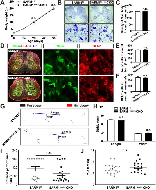 SARM1 promotes neuroinflammation and inhibits neural regeneration after ...