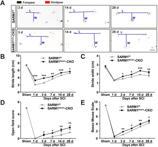 SARM1 promotes neuroinflammation and inhibits neural regeneration after ...