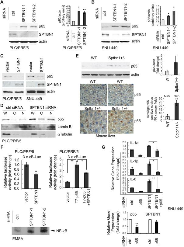 SPTBN1 inhibits inflammatory responses and hepatocarcinogenesis via the ...