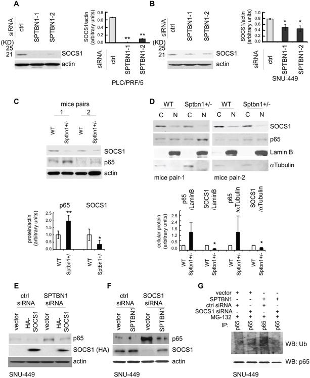 SPTBN1 inhibits inflammatory responses and hepatocarcinogenesis via the ...