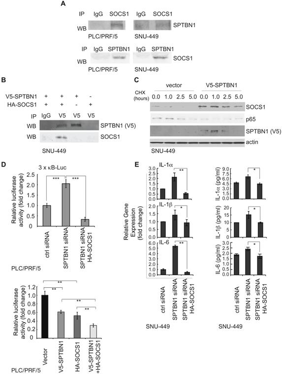SPTBN1 inhibits inflammatory responses and hepatocarcinogenesis via the ...
