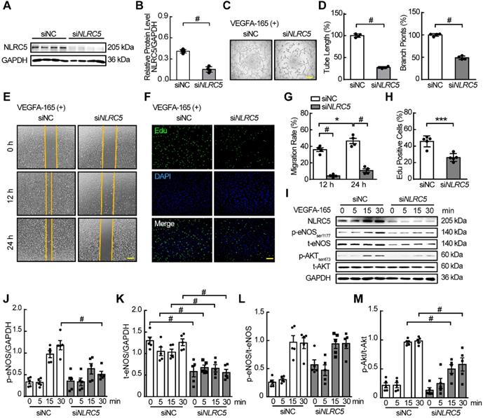 The subcellular redistribution of NLRC5 promotes angiogenesis via ...