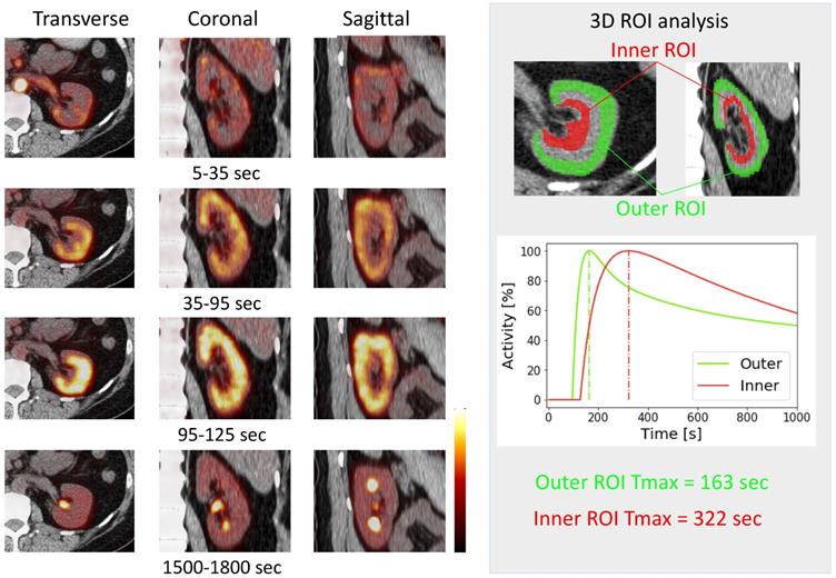 Current and future perspectives on functional molecular imaging in ...