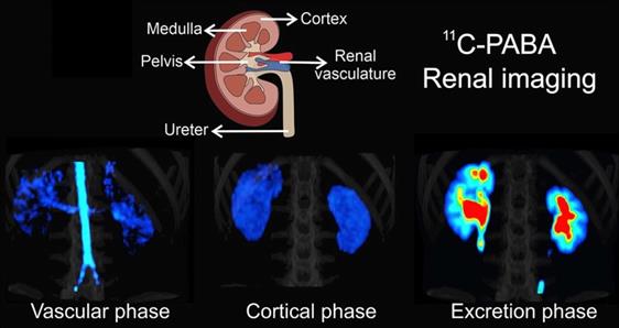 Current and future perspectives on functional molecular imaging in ...