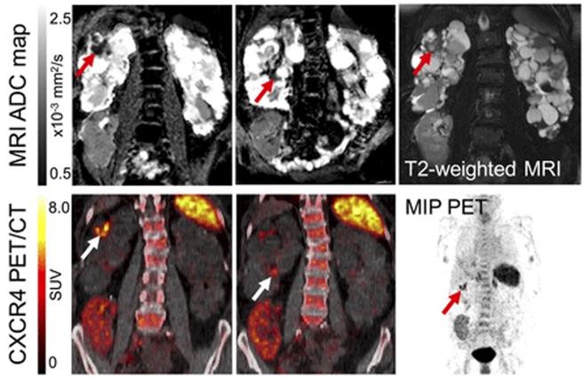 Current and future perspectives on functional molecular imaging in ...