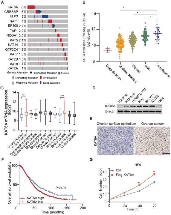 KAT6A, a novel regulator of β-catenin, promotes tumorigenicity and ...