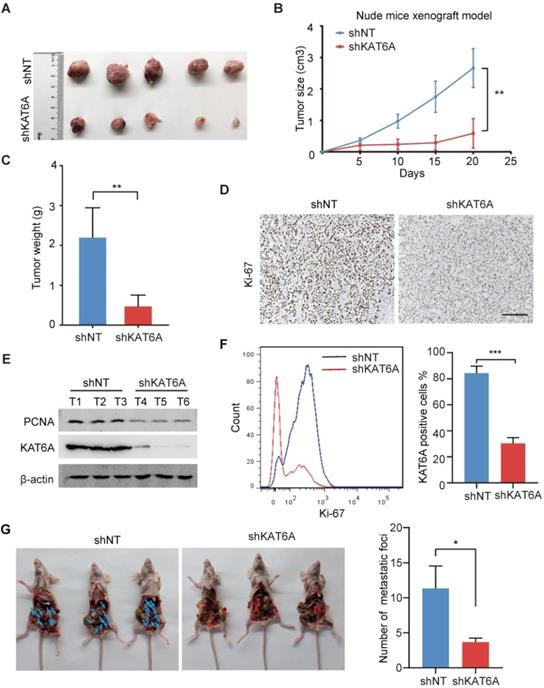 KAT6A, a novel regulator of β-catenin, promotes tumorigenicity and ...