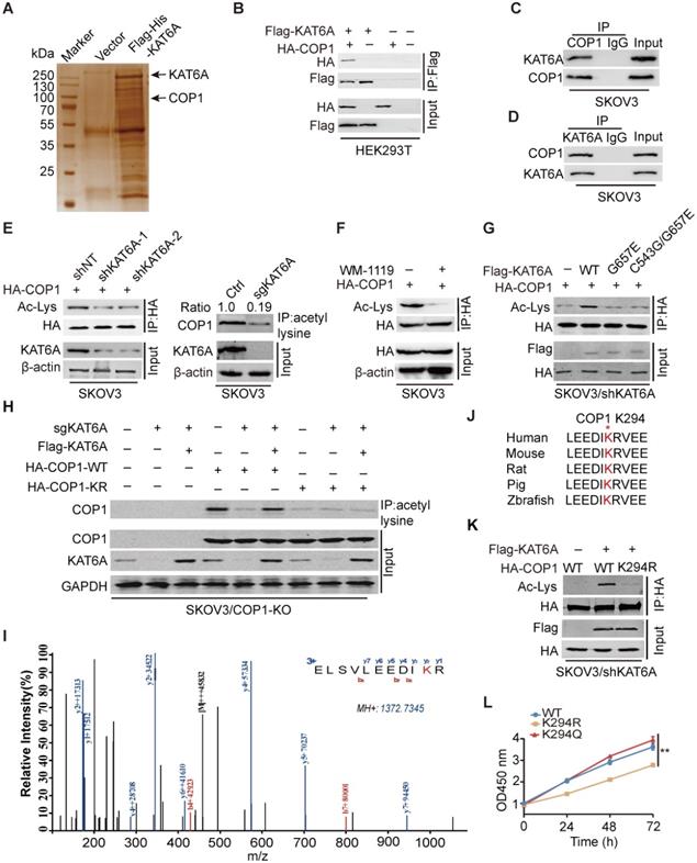 KAT6A, a novel regulator of β-catenin, promotes tumorigenicity and ...