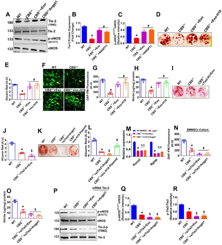 Exosomal lncRNA-H19 promotes osteogenesis and angiogenesis through ...