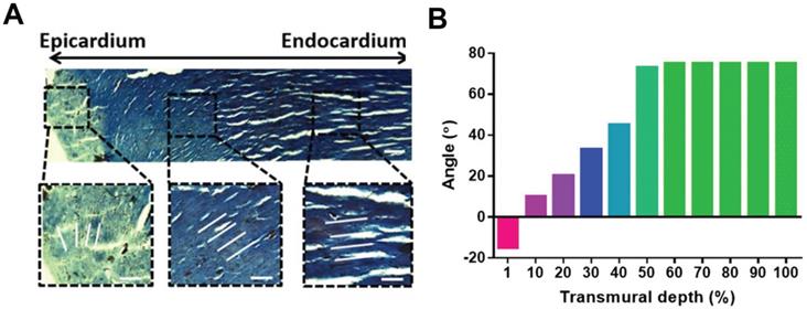 3D bioprinting in cardiac tissue engineering