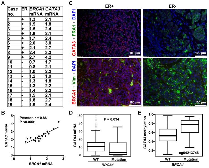 GATA3 functions downstream of BRCA1 to suppress EMT in breast cancer