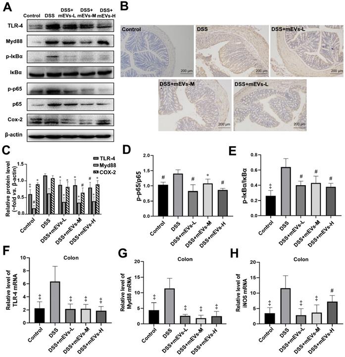 Milk-derived extracellular vesicles alleviate ulcerative colitis by ...