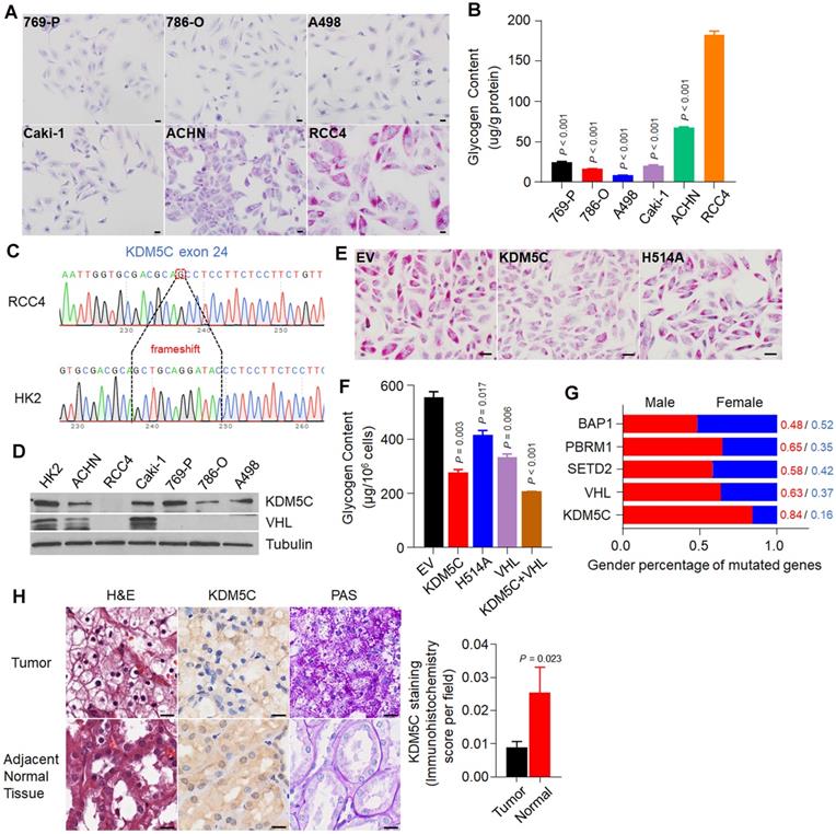 Deficiency of the X-inactivation escaping gene KDM5C in clear cell ...
