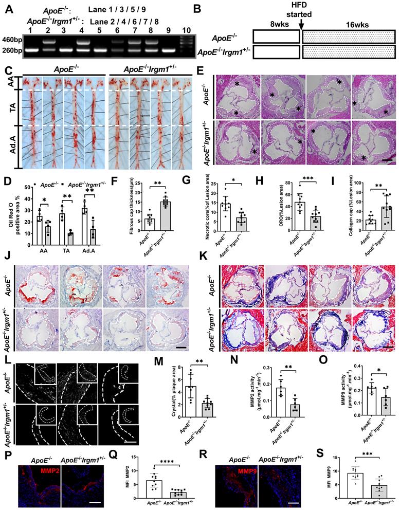 IRGM/Irgm1 facilitates macrophage apoptosis through ROS generation and ...