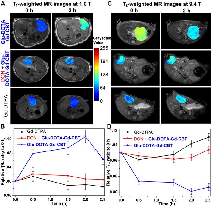 Simultaneous enhancement of T1 and T2 magnetic resonance imaging of ...