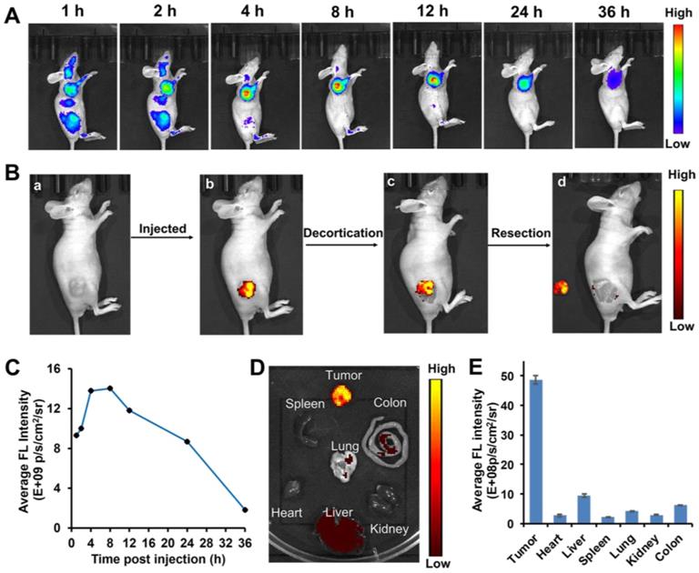 TME-targeting theranostic agent uses NIR tracking for tumor diagnosis ...