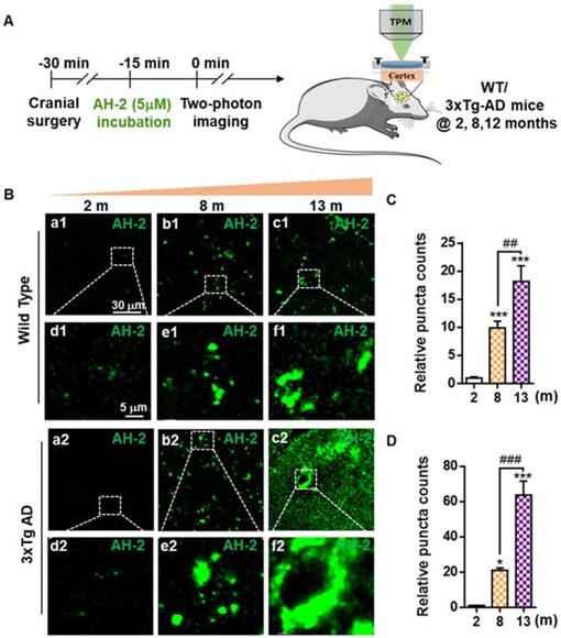 High-fidelity imaging of amyloid-beta deposits with an ultrasensitive ...