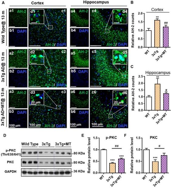 High-fidelity imaging of amyloid-beta deposits with an ultrasensitive ...