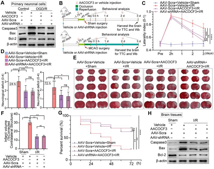 Neuronal STAT3/HIF-1α/PTRF axis-mediated bioenergetic disturbance ...