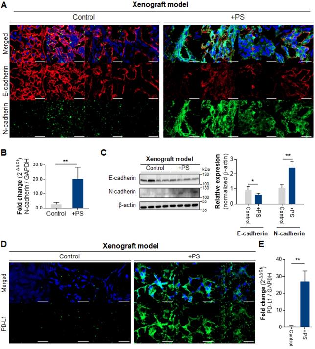 Enhanced ASGR2 by microplastic exposure leads to resistance to therapy ...