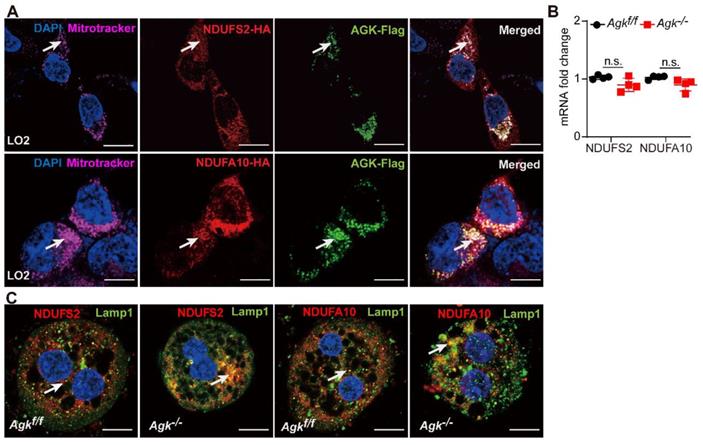 AGK regulates the progression to NASH by affecting mitochondria complex ...