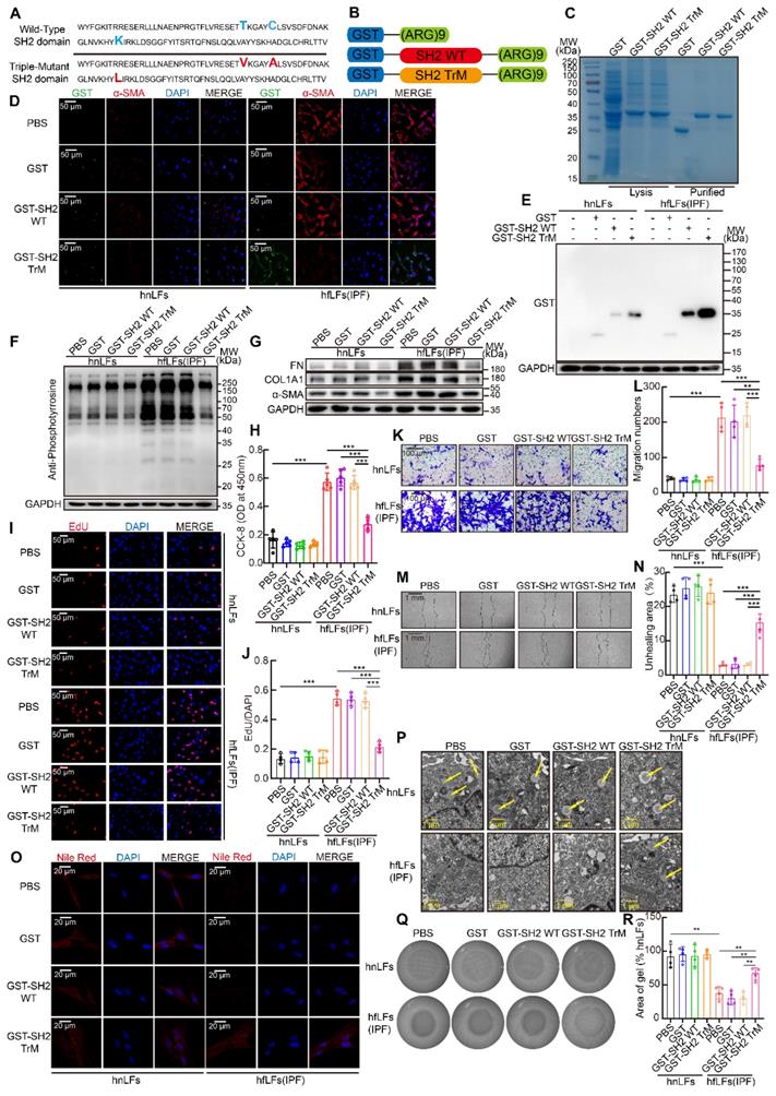 Blockade of phosphotyrosine pathways suggesting SH2 superbinder as a ...
