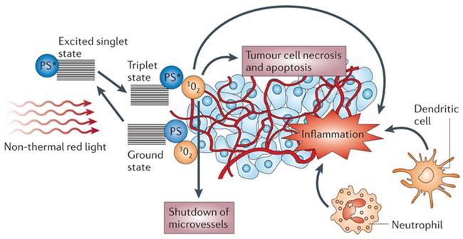How to improve photodynamic therapy-induced antitumor immunity for ...