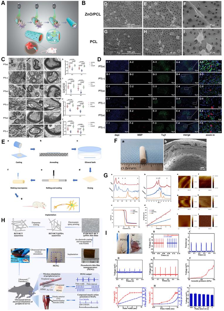 Biomechanical microenvironment in peripheral nerve regeneration: from ...