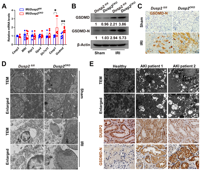 DUSP2-mediated inhibition of tubular epithelial cell pyroptosis confers ...