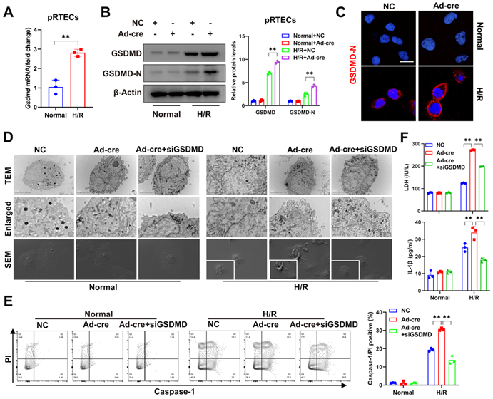 DUSP2-mediated inhibition of tubular epithelial cell pyroptosis confers ...