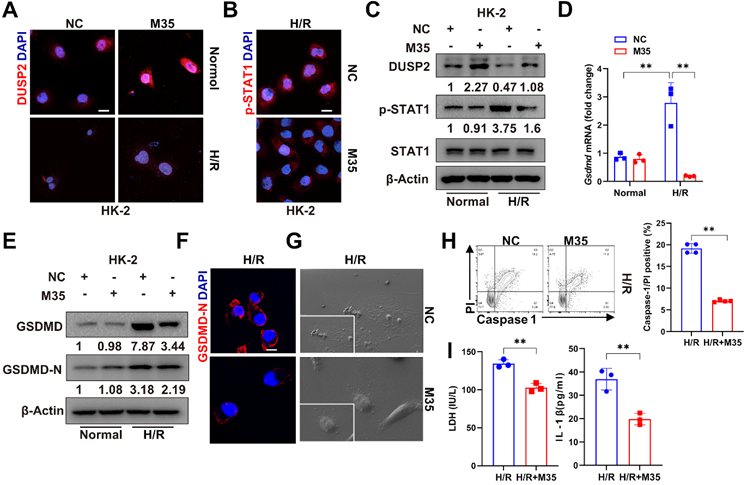 DUSP2-mediated inhibition of tubular epithelial cell pyroptosis confers ...