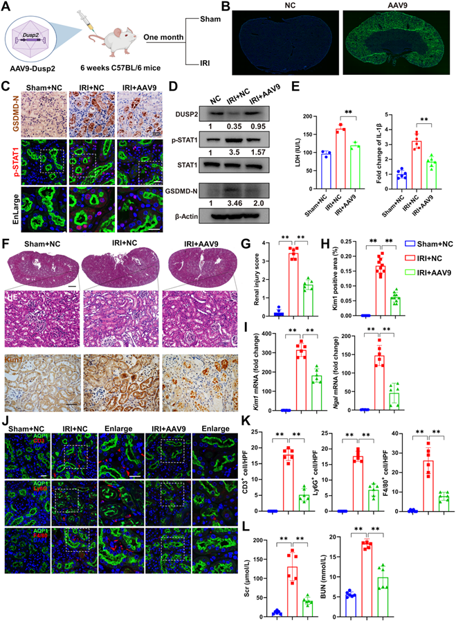 DUSP2-mediated inhibition of tubular epithelial cell pyroptosis confers ...