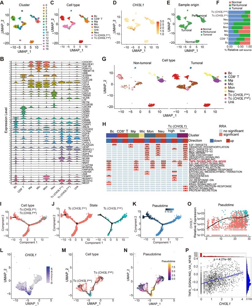 Chitinase-3 like-protein-1 promotes glioma progression via the NF-κB ...