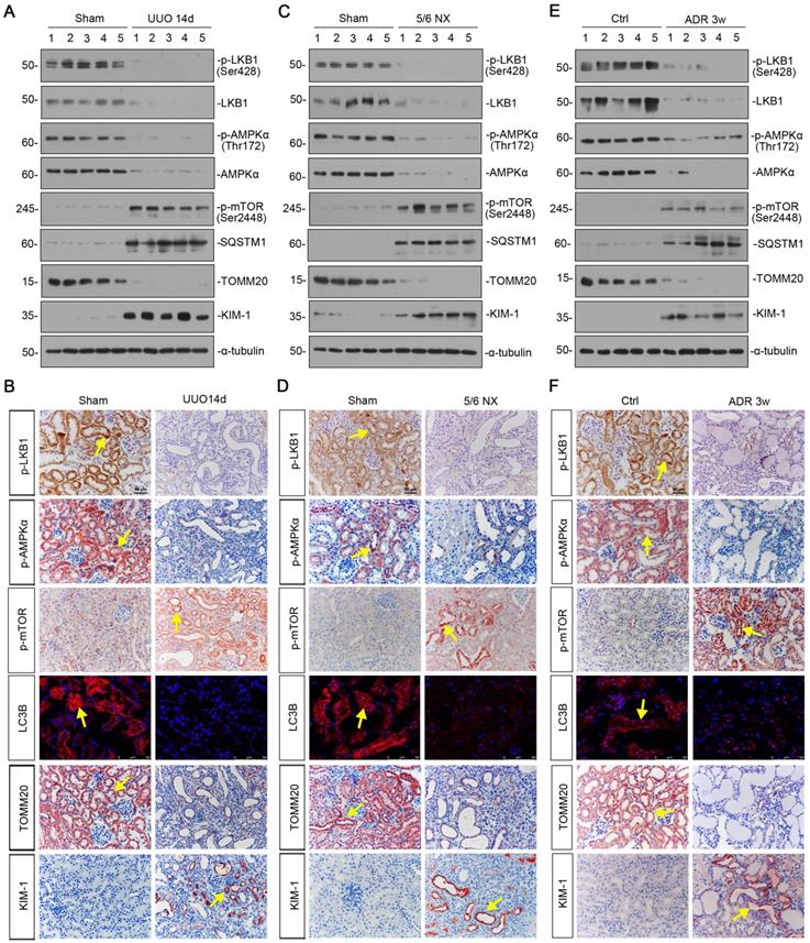 A new LKB1 activator, piericidin analogue S14, retards renal fibrosis through promoting ...