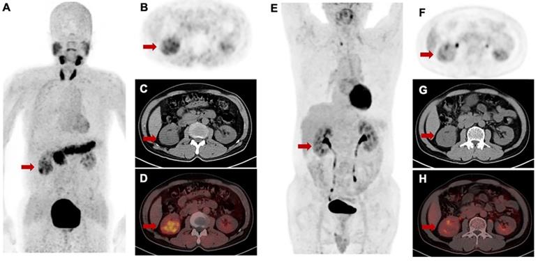 Synthesis, preclinical evaluation and radiation dosimetry of a dual ...