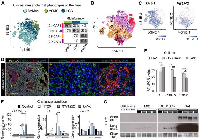 The landscape of cancer-associated fibroblasts in colorectal cancer ...