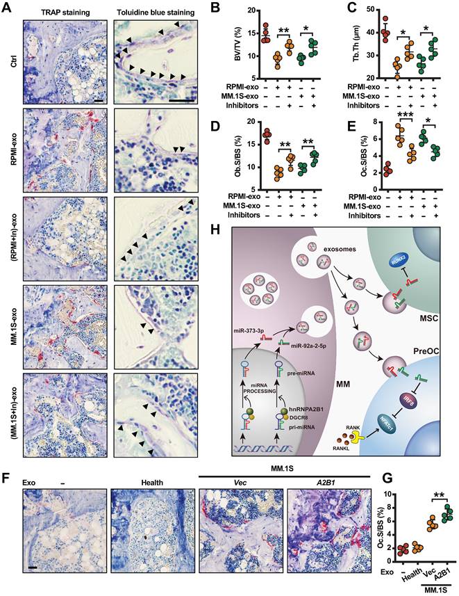 m6A reader hnRNPA2B1 drives multiple myeloma osteolytic bone disease