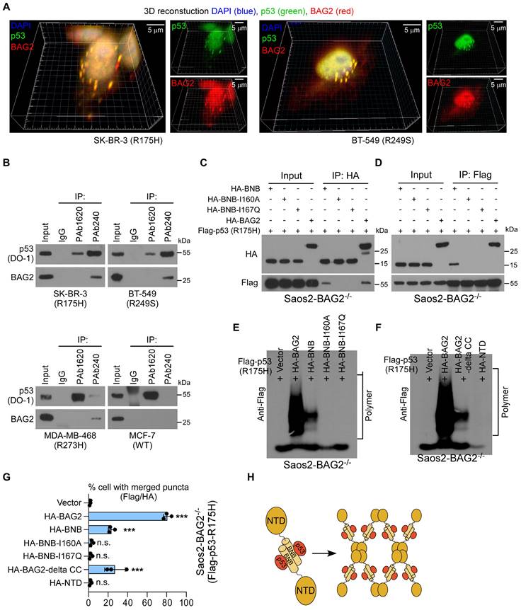 BAG2 drives chemoresistance of breast cancer by exacerbating mutant p53 ...
