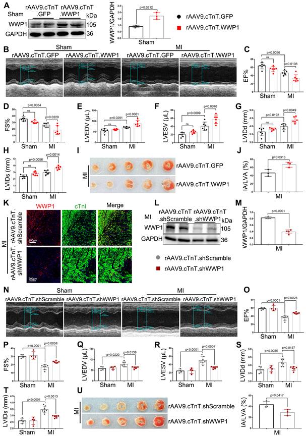 Targeting WWP1 ameliorates cardiac ischemic injury by suppressing KLF15 ...