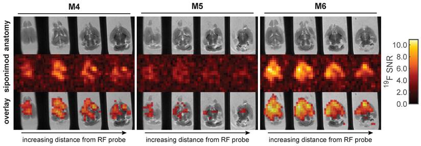 First in vivo fluorine-19 magnetic resonance imaging of the multiple ...