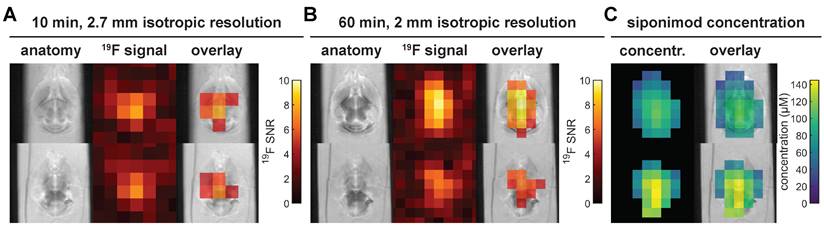 First in vivo fluorine-19 magnetic resonance imaging of the multiple ...