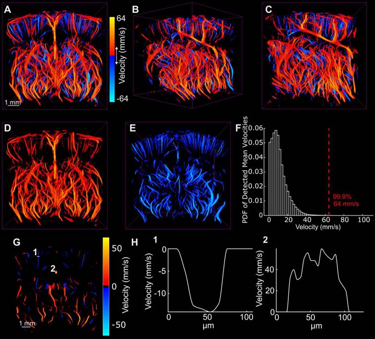 Non-invasive transcranial volumetric ultrasound localization microscopy ...