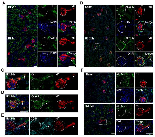 WT1+ glomerular parietal epithelial progenitors promote renal proximal ...