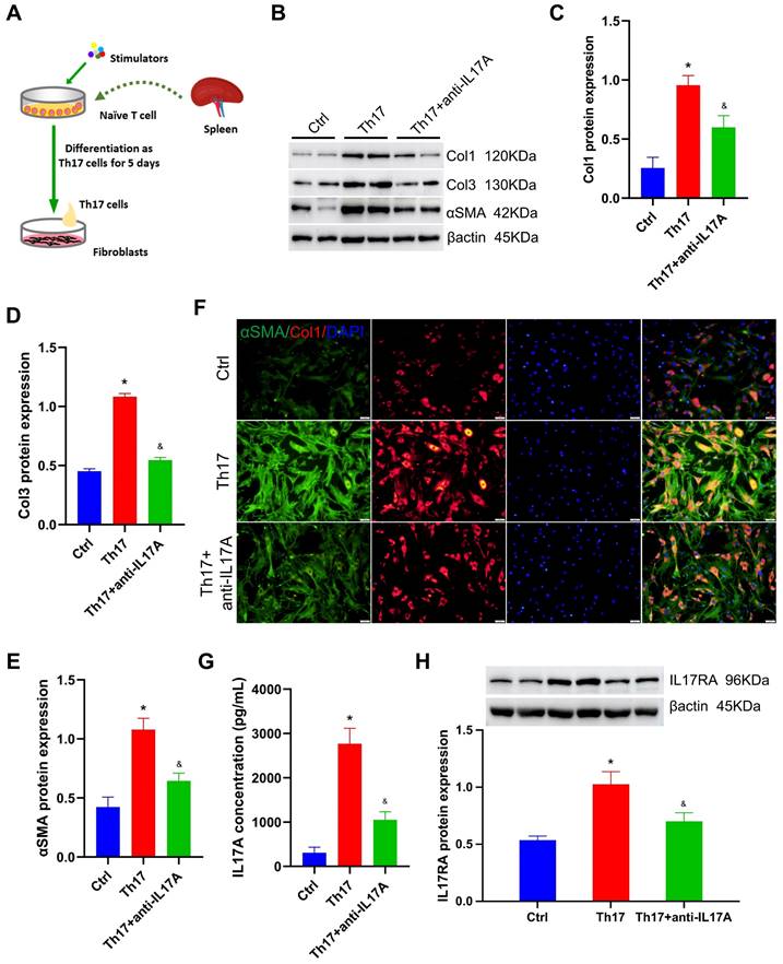 Inhibition of Th17 cells by donepezil ameliorates experimental lung ...