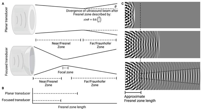 A systematic review of ultrasound-mediated drug delivery to the eye and ...