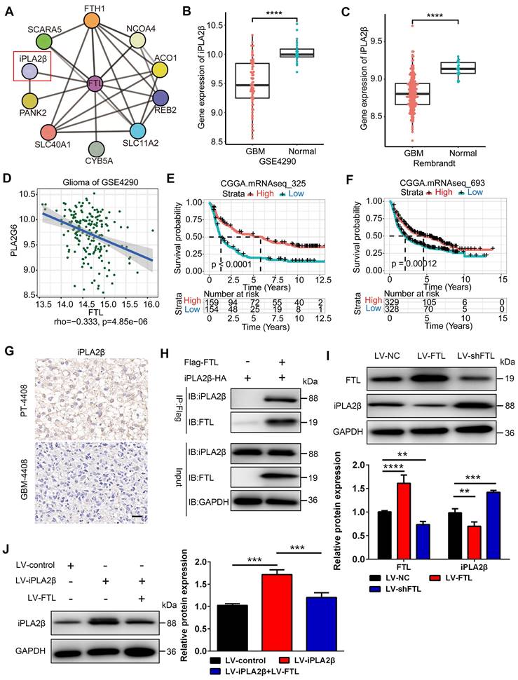 Ferritin light chain promotes the reprogramming of glioma immune ...