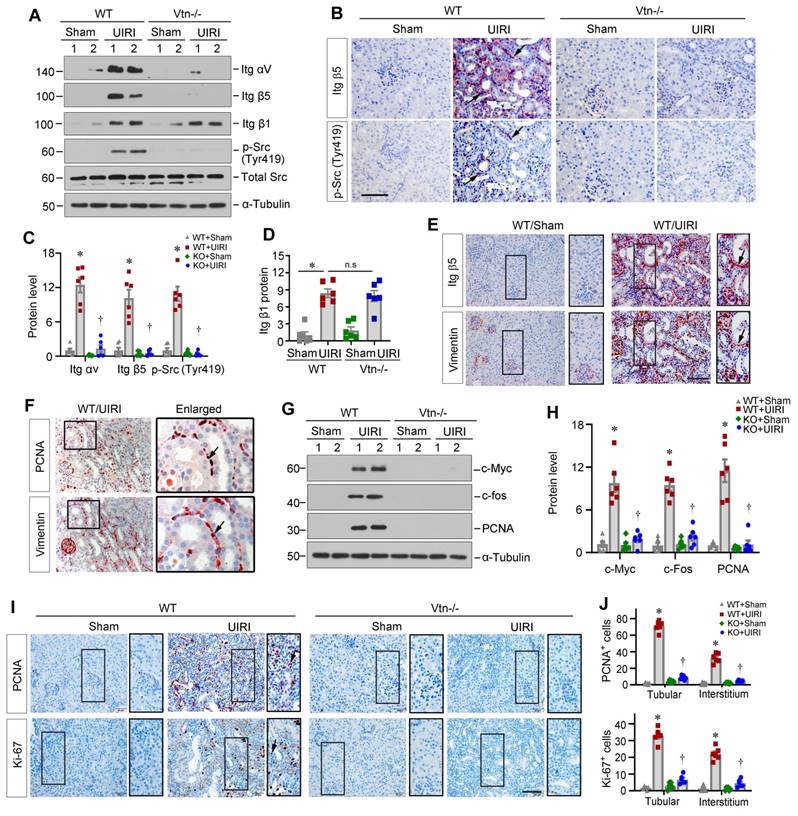 Macrophage promotes fibroblast activation and kidney fibrosis by ...